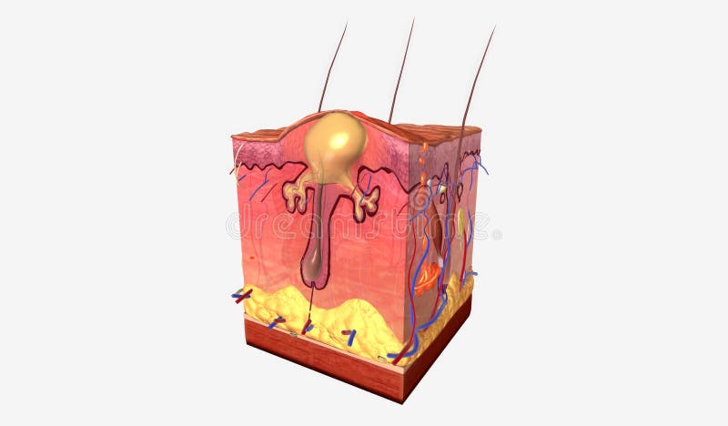 Papule is a Type of Acne Characterized by a Large, Inflamed Bump on the ...