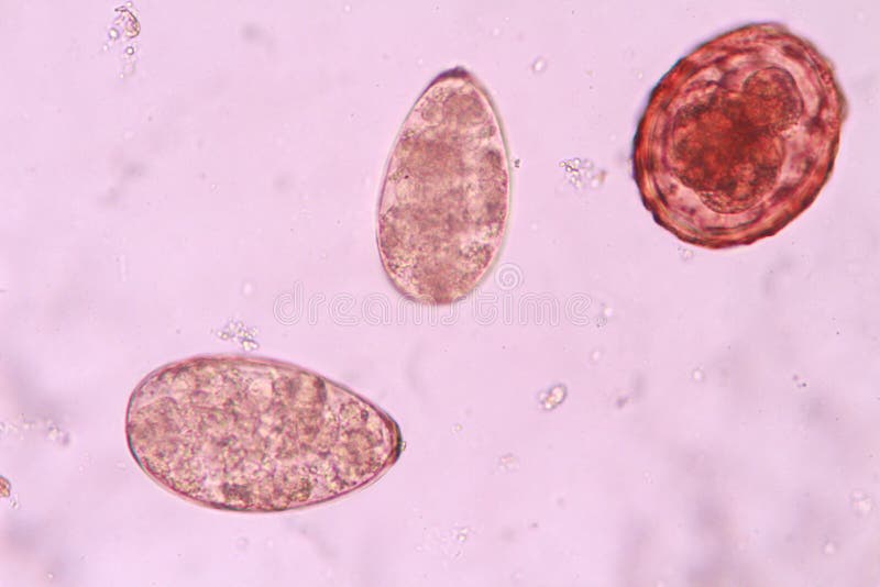 Paragonimus stock image. Image of biological, disease - 80362073