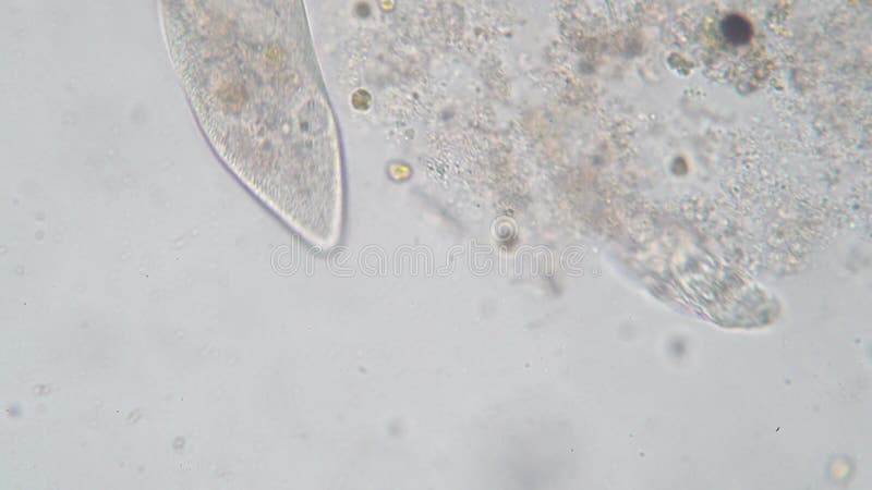 Paramecium Caudatum Under A Microscope 400x