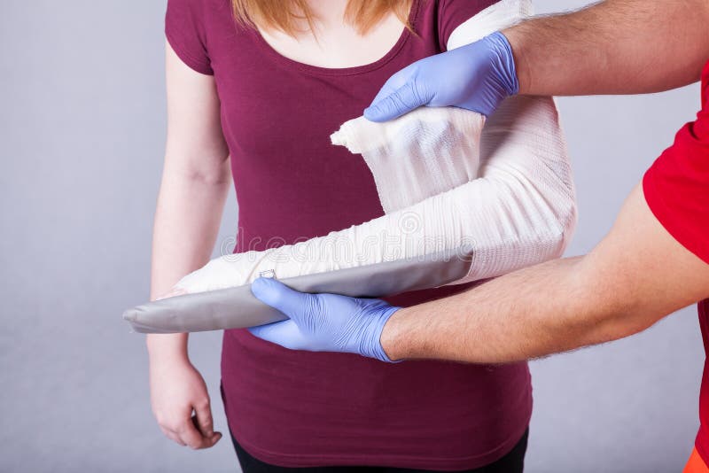 Woman with bandaged arm stock image. Image of broken - 37543839