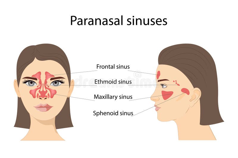 Paranasal Sinuses. Frontal, Ethmoidal, Sphenoidal, and Maxillary ...