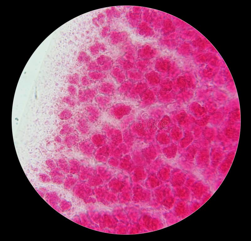 Parasiet stock foto. Image of technologie, biologisch - 28670276