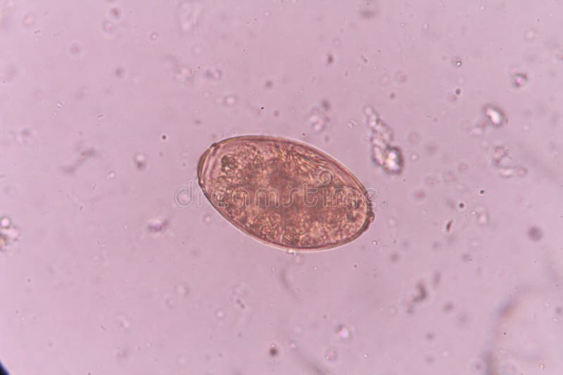 Macro Hookworm-eitjes Parasiet in Ontlasting Stock Foto - Image of kruk ...