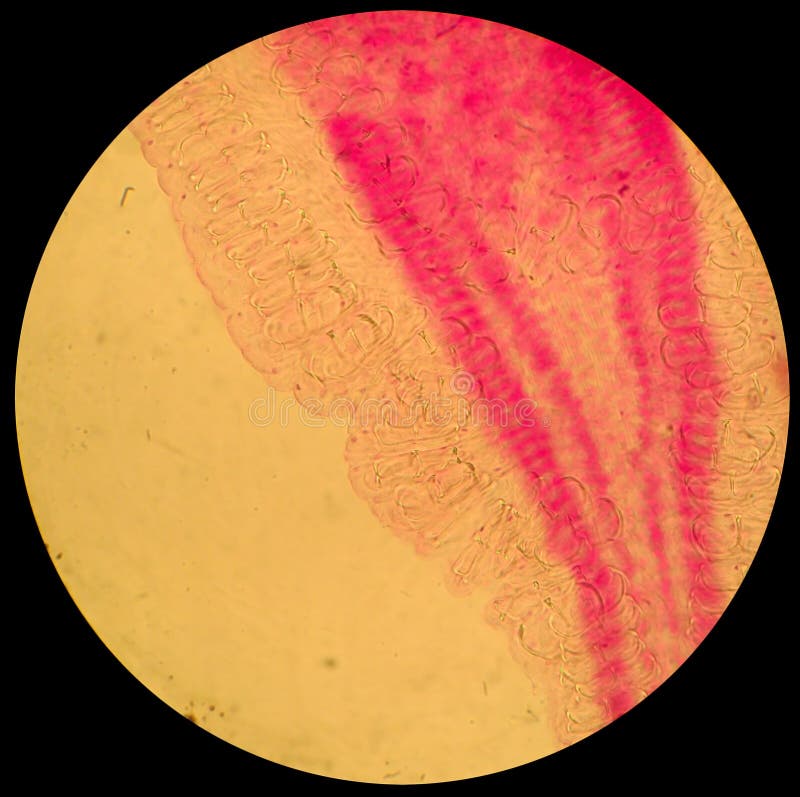 Parasiet van de vissen stock afbeelding. Image of milieu - 30356505