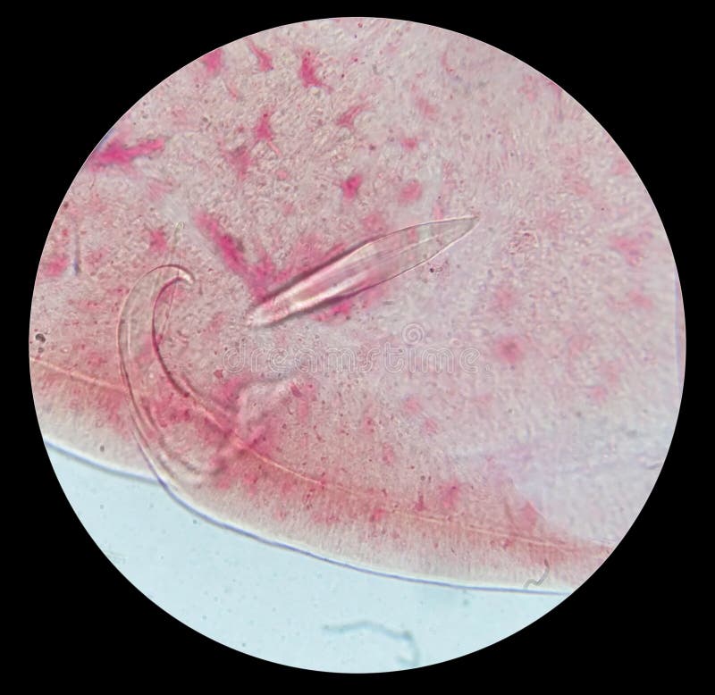 Head Skin with Hair Follicles. Root of Hair Under the Microscope Stock ...