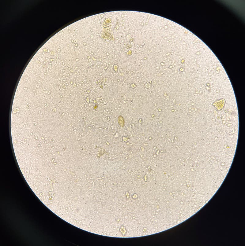 Parasite egg in stool exam stock photo. Image of analyzing - 311073164