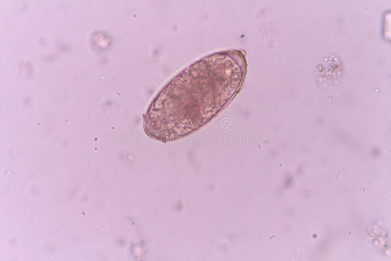 Lung Flukes Egg Stock Photos - Free & Royalty-Free Stock Photos from ...