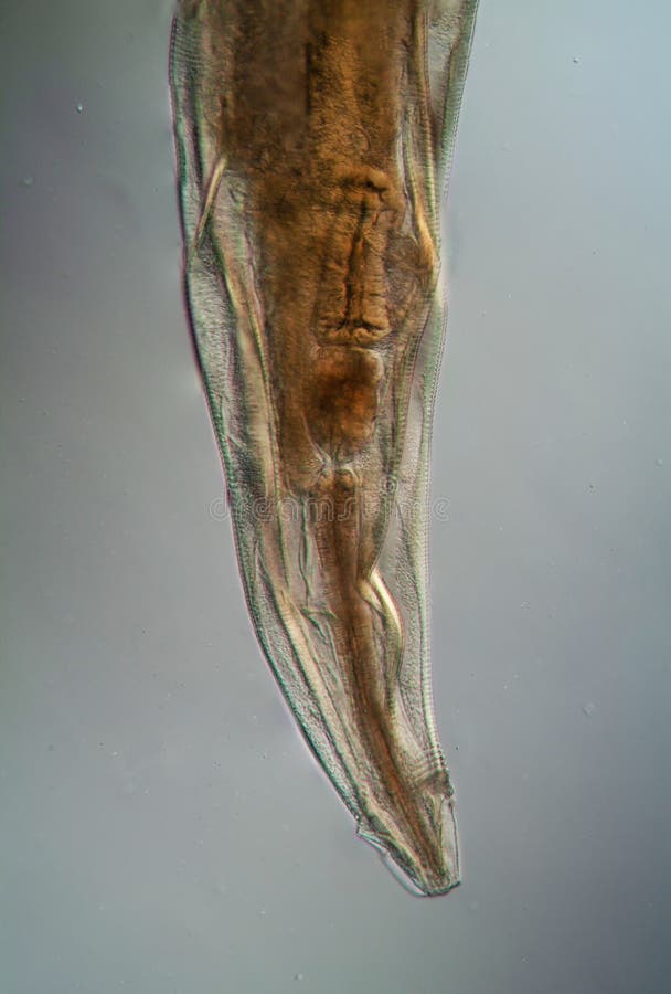 100 Parasite Oxyure Oxiuris X Image stock - Image du propagation ...