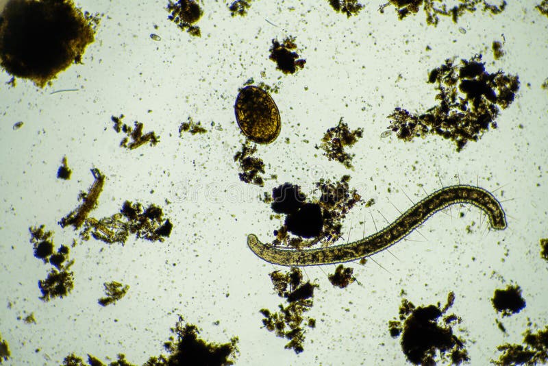 Parasites Humains Dans L'intestin Humain Image stock - Image du humain ...