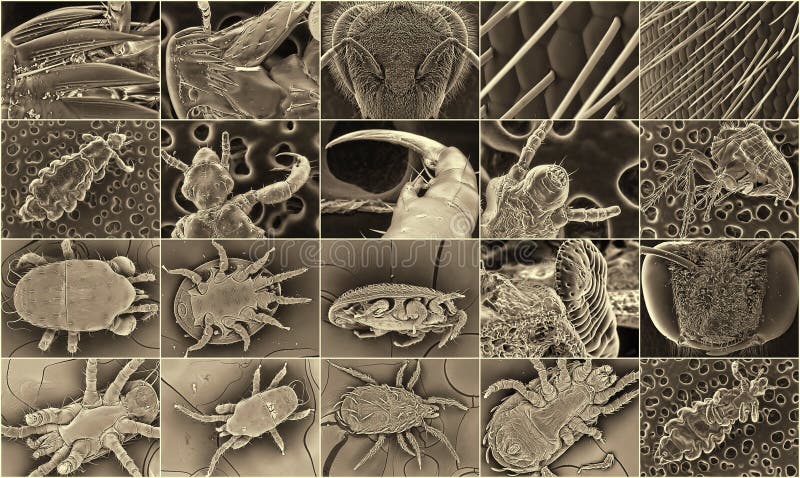 Parasite Electron Microscope