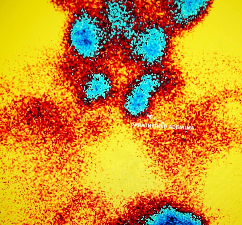 Hormone Canine Stock Photos - Free & Royalty-Free Stock Photos from ...