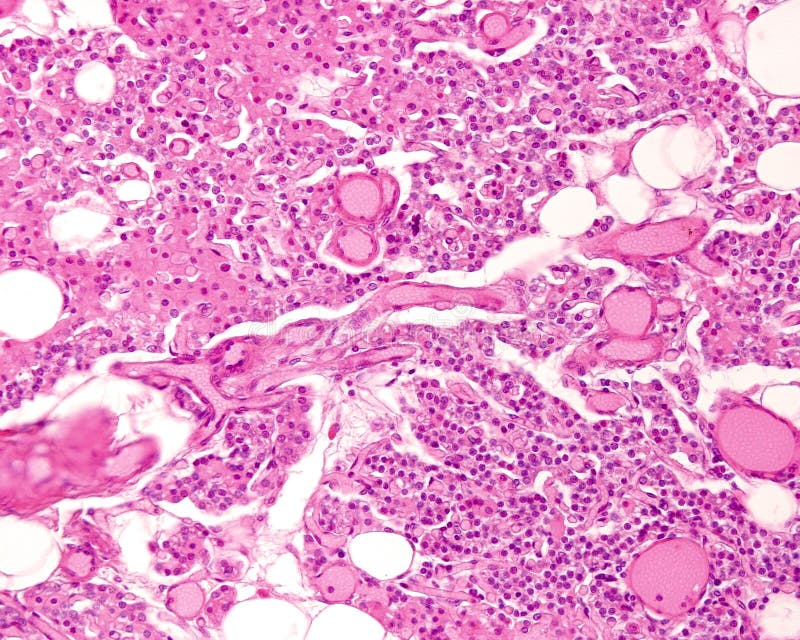 Parathyroid Gland. Cell Types Stock Image - Image of nuclei, hormone ...