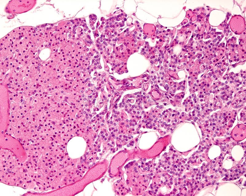 Parathyroid Gland. Cell Types Stock Photo - Image of cell, parathyroid ...