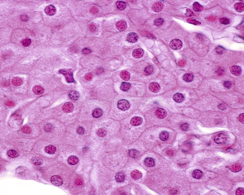 Parathyroid Gland. Oxyphilic Cells Stock Photo - Image of capillary ...