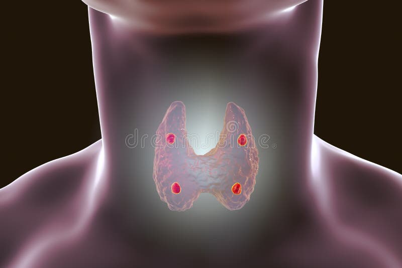 Parathyroid glands anatomy stock illustration. Illustration of ...