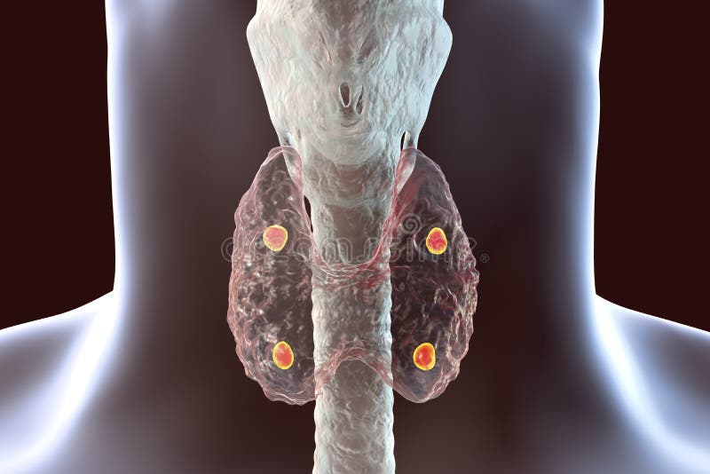 Parathyroid Glands Anatomy Stock Illustration Illustration Of