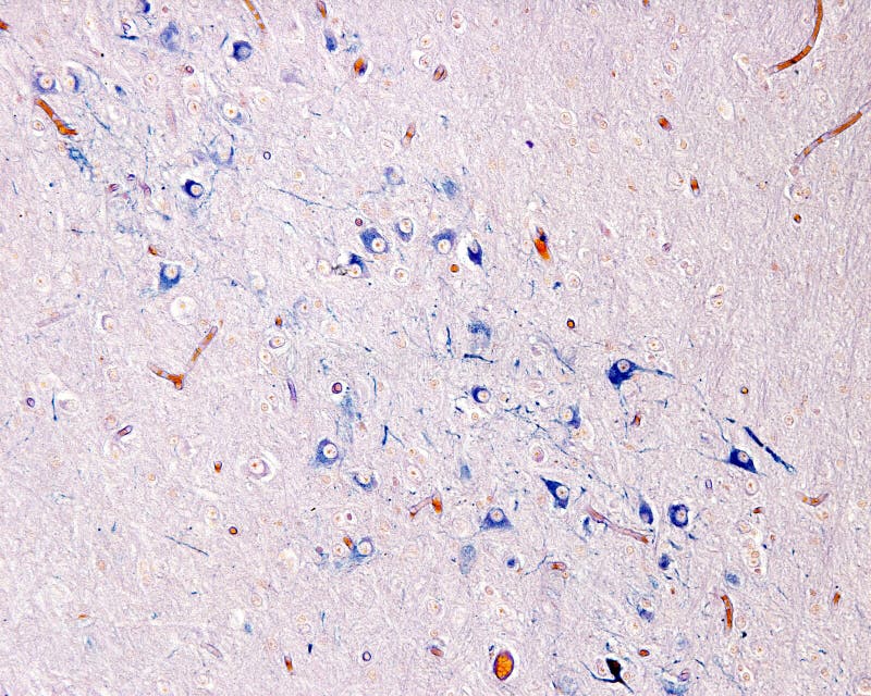 Paraventricular Nucleus. Paraldehyde-thionine Stock Image - Image of ...