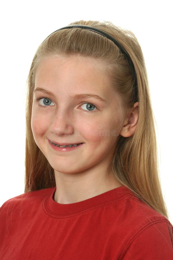 Parentesi graffe dentali fotografia stock. Immagine di ortodontico ...