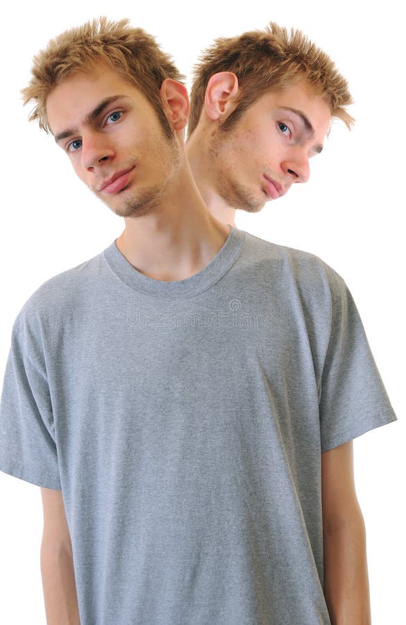 Pares de gemelos siameses foto de archivo. Imagen de adolescente - 15089866