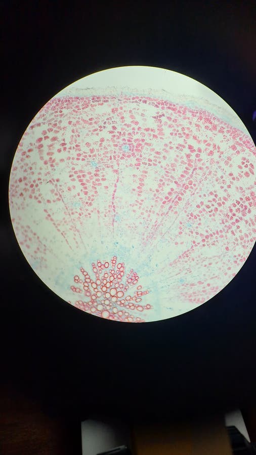 Xylem and Other Tissues of Beet Root Under a Microscope Stock Image ...