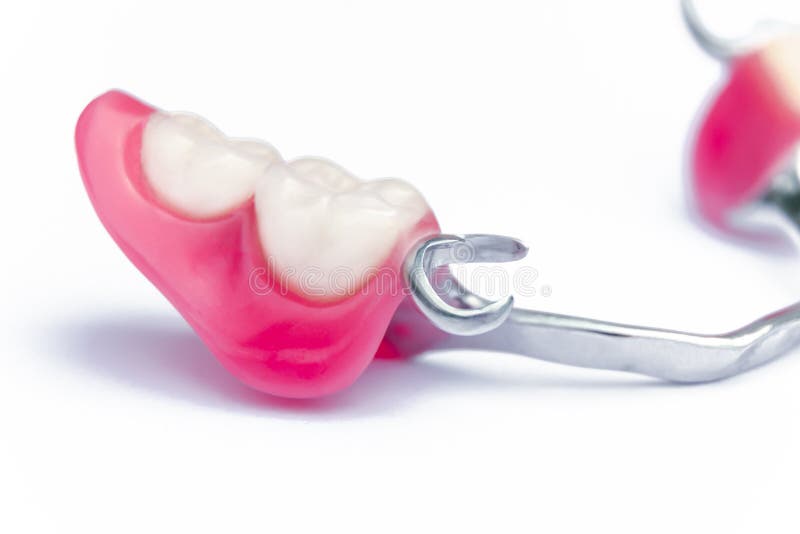 Part of Clasp Prosthesis in Focus. Fixation Clamer. False Teeth on the ...