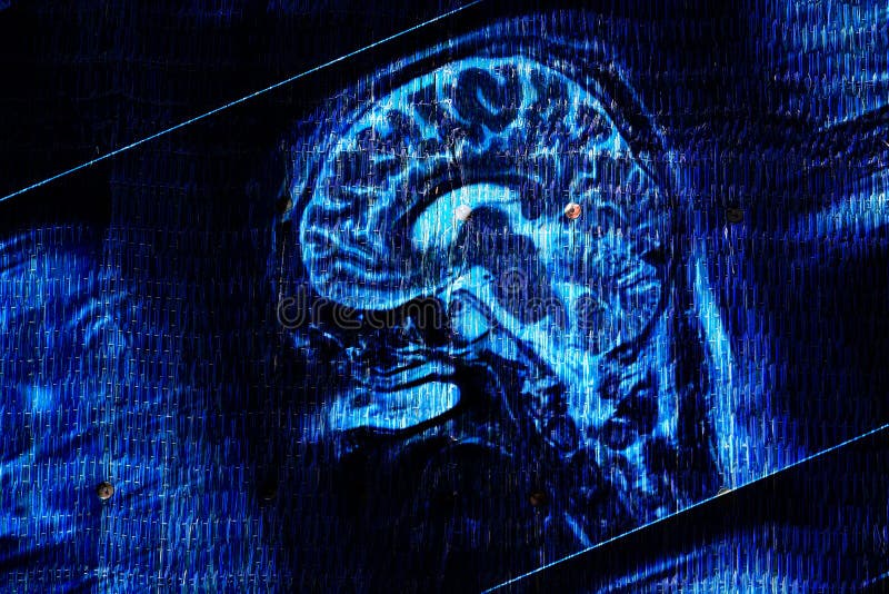 Part of a MRI Scan of a Human Head As a Medical Background Stock Photo ...