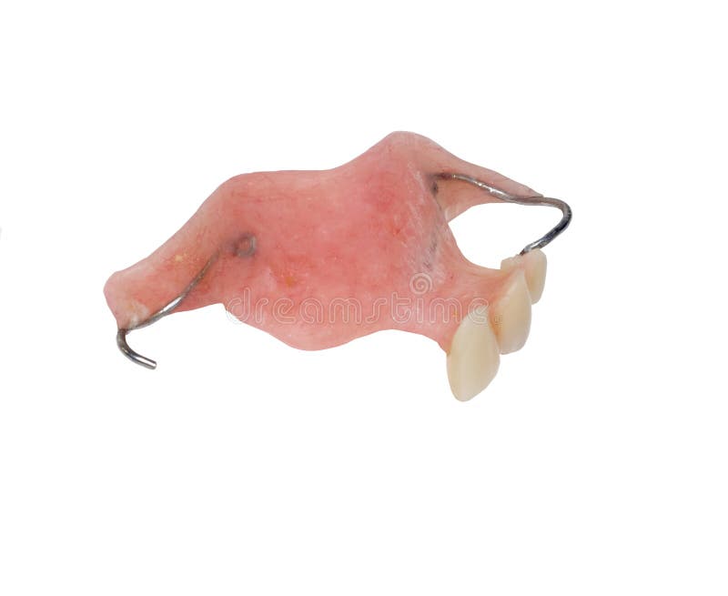 Partial stock image. Image of mouth, plate, wire, isolated - 14842489