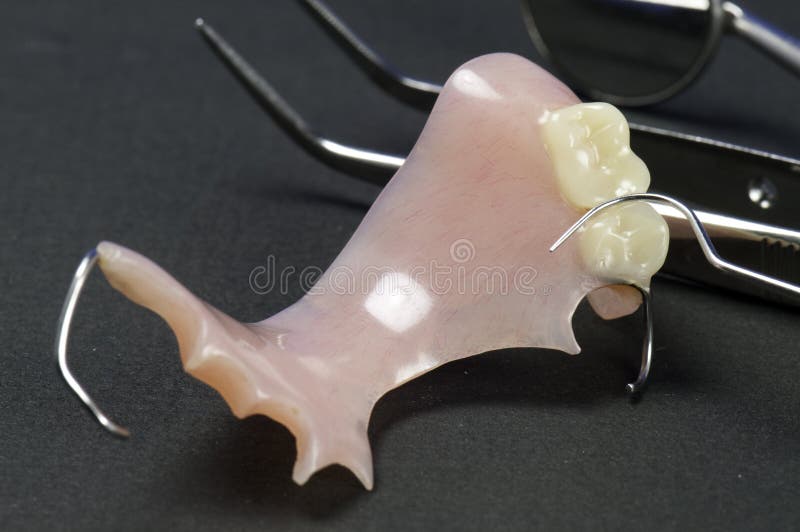 Partial Dental Bridge stock photo. Image of glass, dental - 10219560