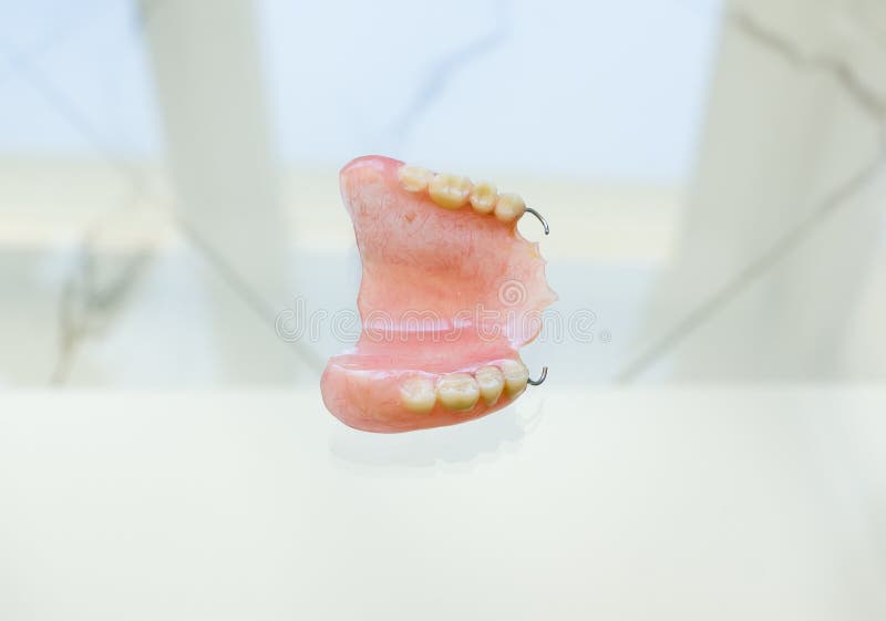 Partial plate denture stock photo. Image of custom, dentist - 151430722