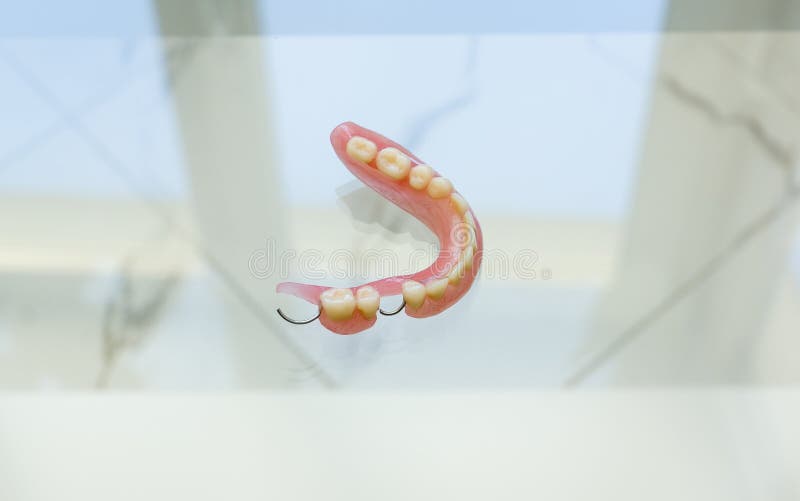 Partial plate denture stock image. Image of partials - 147302391