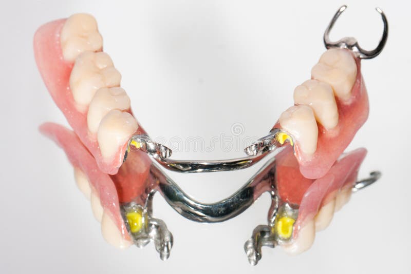 Lower denture stock photo. Image of dental, medical, rehabilitation ...