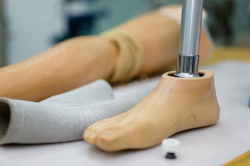 Parts of Artificial Leg and Various Tools in Prosthetic Workshop Stock ...
