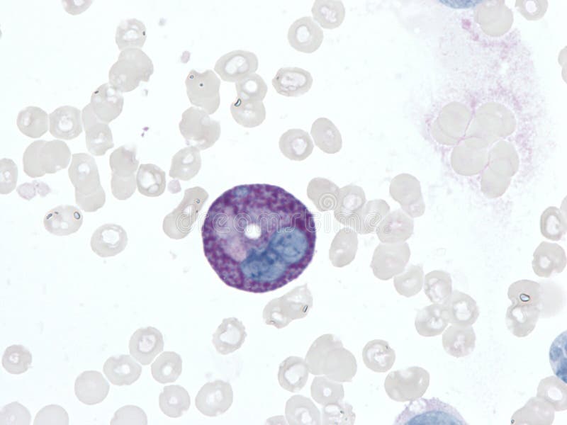 Pas Stain Stock Photos - Free & Royalty-Free Stock Photos from Dreamstime