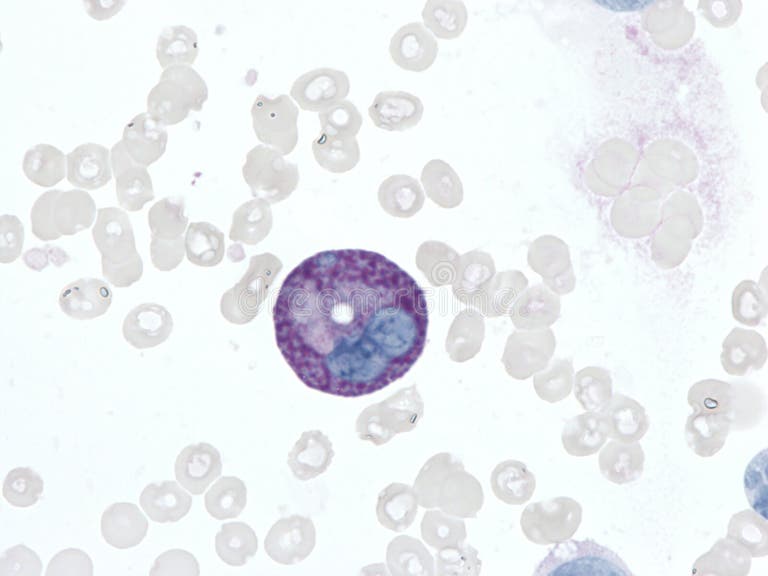 Pas Stain Stock Photos - Free & Royalty-Free Stock Photos from Dreamstime