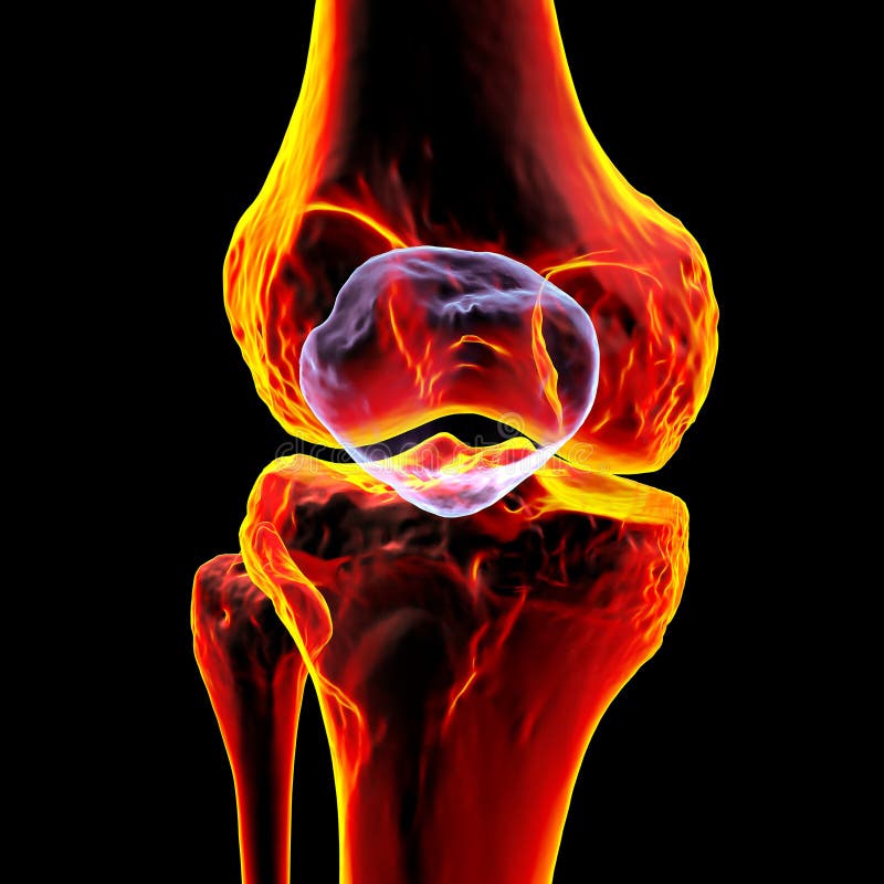 Patella Anatomy, 3D Illustration Stock Illustration - Illustration of ...