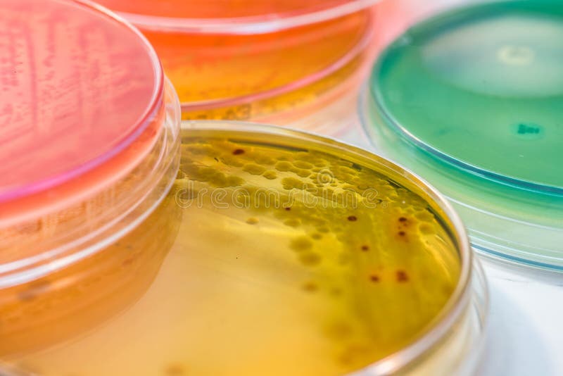 Pathogen Growth on Selective Media. Stock Photo - Image of microbiology ...