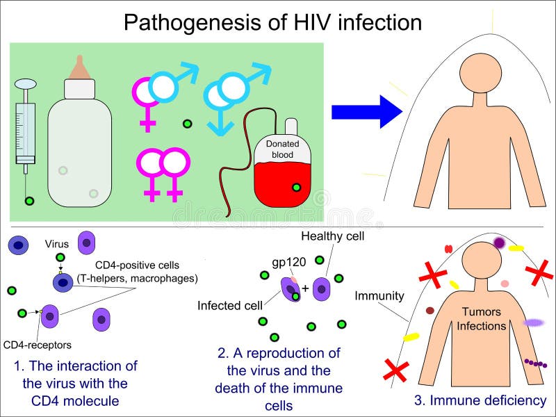 Pathogenesis Of HIV Infection Stock Vector - Image: 69423245 Pathogenesis Of HIV Infection Stock Vector - Image: 69423245