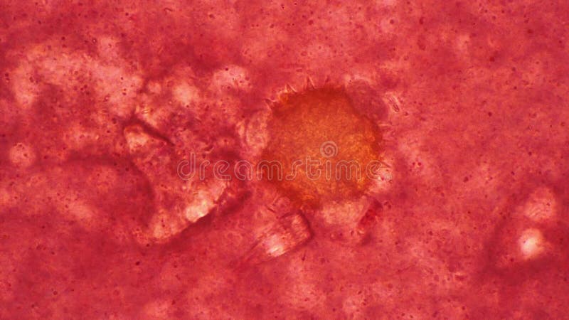 Blood of Human Smear Filmed with Oblique Illumination Under Microscope ...