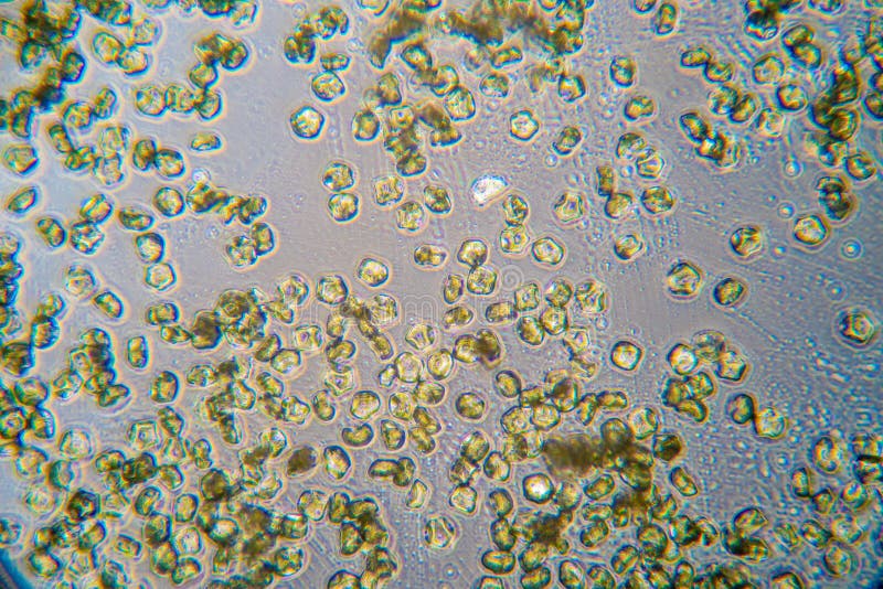 Pathogens Magnified by a Microscope Stock Photo - Image of illness ...