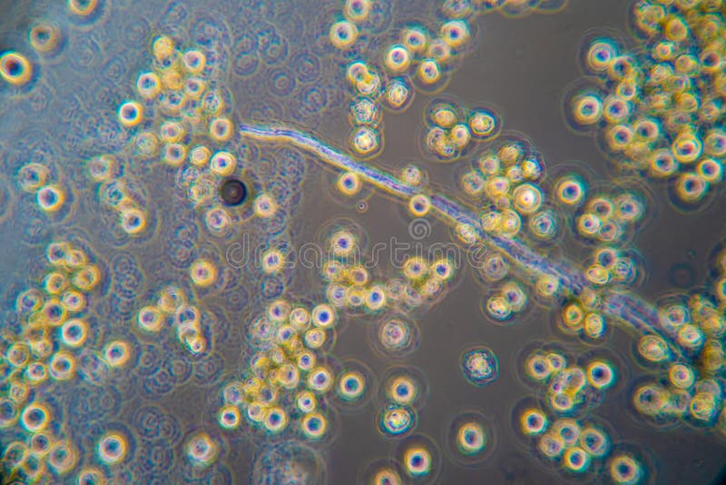 Pathogens Magnified by a Microscope Stock Photo - Image of illness ...