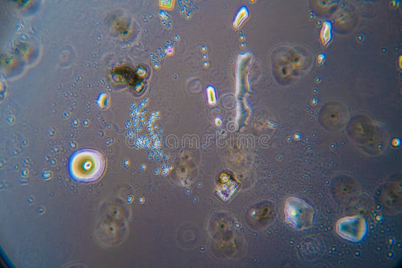 Pathogens Magnified by a Microscope Stock Image - Image of biological ...