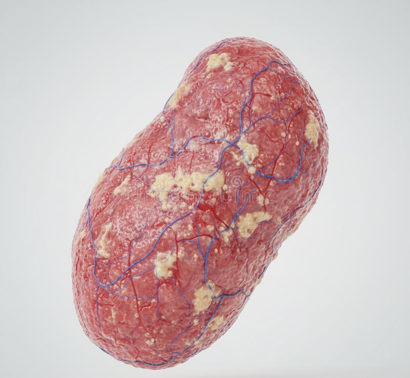 Pathology and Study: Internal Organ Affected by Disease Stock ...