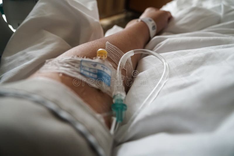 Patient Arm with Iv Tube at Hospital Stock Image - Image of medical ...
