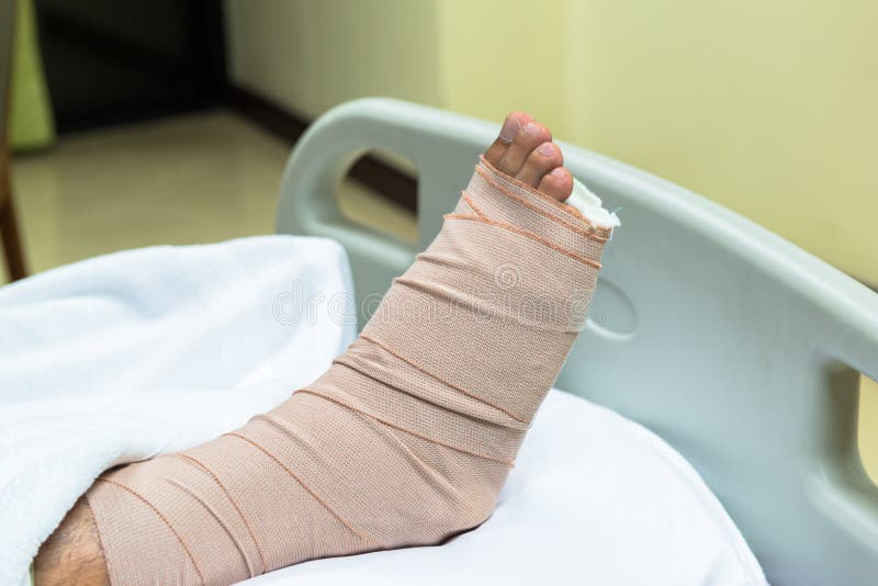 cast bandage Cheaper Than Retail Price> Buy Clothing, Accessories and ...