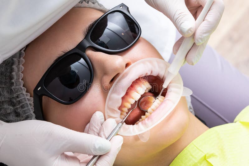 Patient with Cheek Retractor Lying in Dentist Office Stock Image ...
