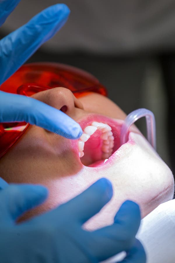 Patient in Dentist Office - Real Work. Stock Photo - Image of dental ...