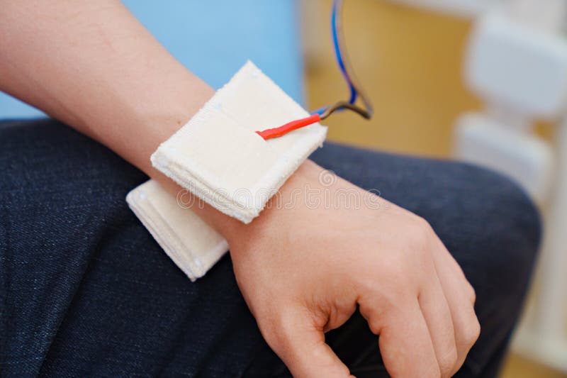 Patient with an Electrotherapy on Hand. Electrical Stimulation. Stock ...