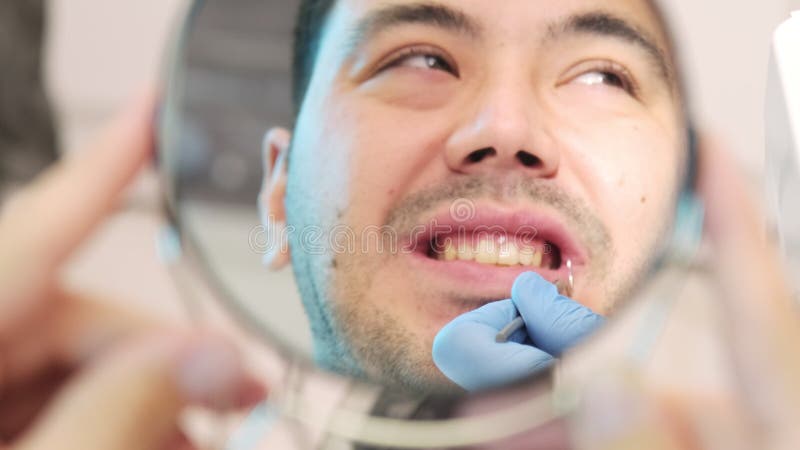 A Patient Examines His Smile in the Mirror during a Dental Check-up ...