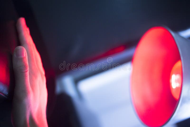 Patient Hand in Red Physiotherapy Heat Treatment Stock Photo - Image of ...