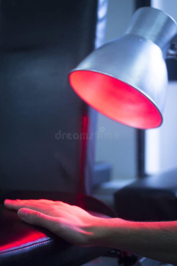 Patient Hand in Red Physiotherapy Heat Treatment Stock Photo - Image of ...